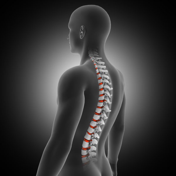 Spondylosis | Ramos Center Interventional & Functional Pain Management
