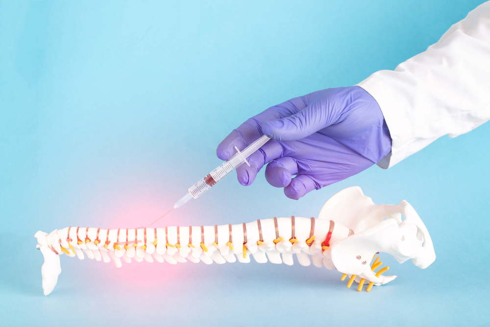 What Are Nerve Blocks and How Do They Provide Lasting Pain Relief ...